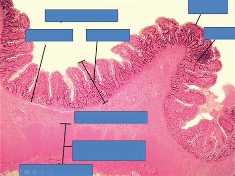 Biol 206l Jejunum Microscope Slide 2 Diagram Quizlet