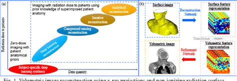 Figure 1 From Data Driven Volumetric Image Generation From Surface Structures Using A Patient