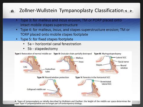 Infections Of The Ear And Temporal Bone Ppt Video Online Download Infections Of The Ear And Temporal Bone Ppt Video Online Download