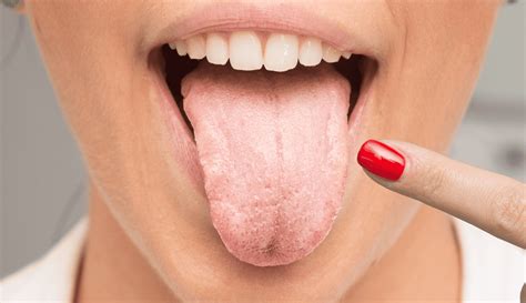 Biting Tongue In Sleep Stop Nighttime Tongue Bites