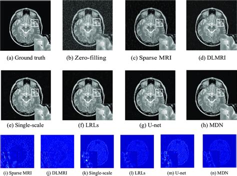 Reconstruction Results For 20 Variable Density Sampling A Original