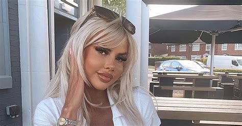 Love Island S Hannah Elizabeth Debuts New Look As She S Latest Star To Dissolve Lip Filler Ok