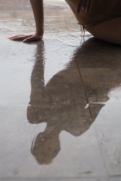 Follow Oligo Dendroglioma Tumbex