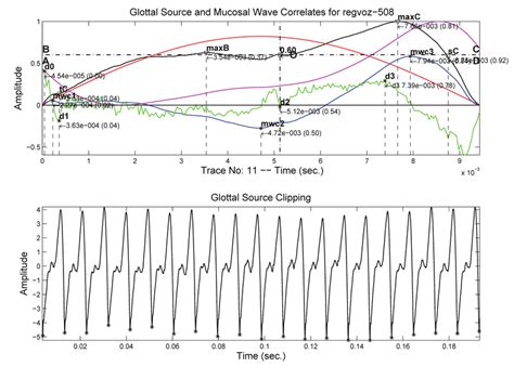 Glottal Source Template Normophonic Male Voice Top Time Domain Download Scientific Diagram