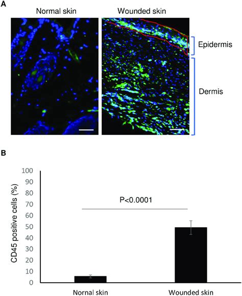 Cd45 Positive Hematopoietic Cells In Skin Wounds Of Mice A