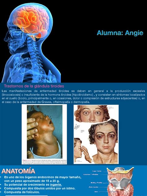 Hipotiroidismo E Hipertiroidismo Pdf Tiroides Hormona