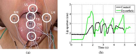 Figure 1 From Learning Mixed Acousticarticulatory Models For Disabled
