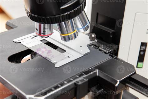 Closeup Of A Microscope Slide With Stained Tissue Biopsy Under The Microscope Cancer Diagnosis