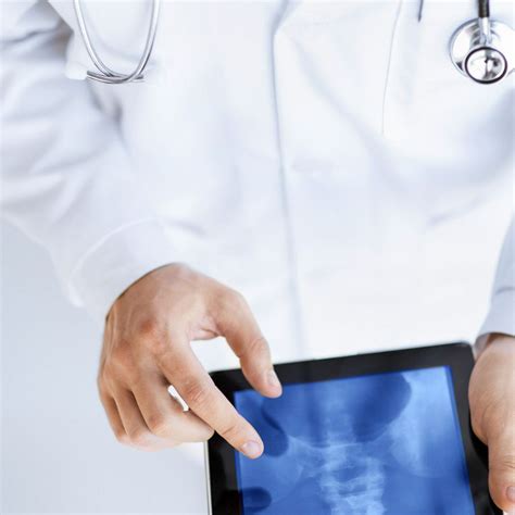 The Edison Alliance Ai Enabled X Ray Detection Of Lung Cancer