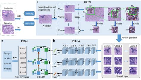 diagram of breast cancer pathological image classification using