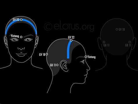 Coronal Suture Zone Master Tungs Acupuncture Elotus Core