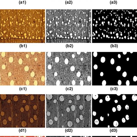 A Binary Image With Hole Filling B Extracted Vessel Elements C Image Download Scientific