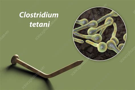 Tetanus Transmission Conceptual Illustration Stock Image F036 6626 Science Photo Library