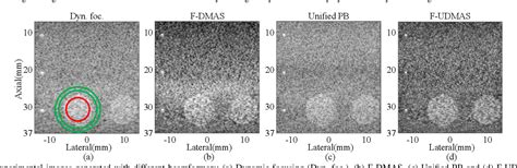 Figure 4 From High Resolution Ultrasound Imaging Using Unified Pixel