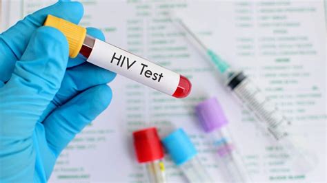 Worried About Stds How Soon An Std Test Detects Infection