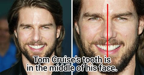 Tom Cruise Tooth Middle Of Face 13 Celebrities Who Had Dental Work