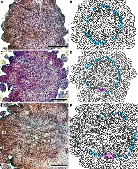 Lycopodium Stem Cortex