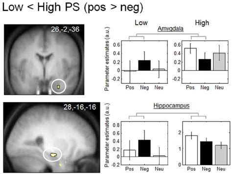 Functional Mri Responses To Positive Vs Negative Pictures Brain