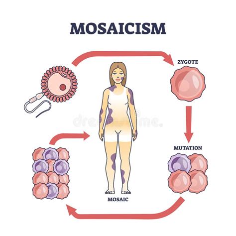 Mosaicism As Medical Genetic Condition With Cellular Defect Outline Diagram Stock Vector