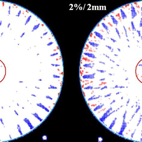 Comparison Between The Pencil Beam Calculation Dose Distribution And Download Scientific