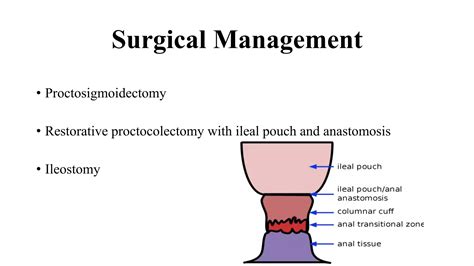 Ulcerative Colitis Pptx