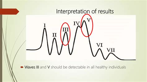 Brainstem Auditory Evoked Potentials Pptx