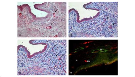 Formalin Fixed Paraffin Embedded Serial Sections Of Peritoneal Download Scientific Diagram