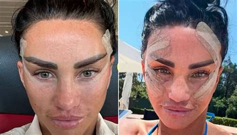 Katie Price Unveils Bandaged Face As She Recovers From Surgery