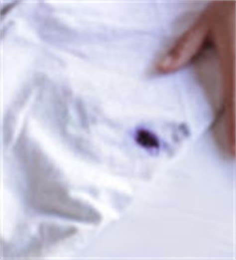 4 Simple Ways To Remove Ball Point Pen Stains From Cotton