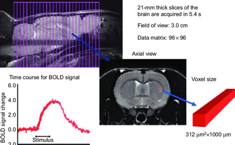 Spatial And Temporal Resolution Top Slice Selection Array On A