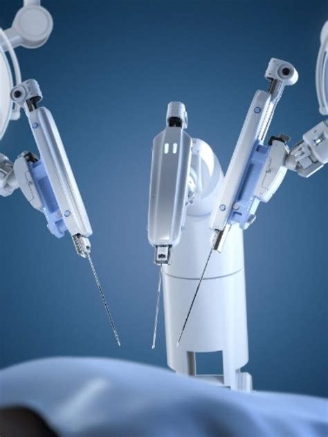 4 Reasons Why Experience Matters In Robotic Radical Nephrectomy Dr