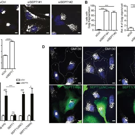Sept1 Is Required For Golgi Integrity A Immunostaining Of A