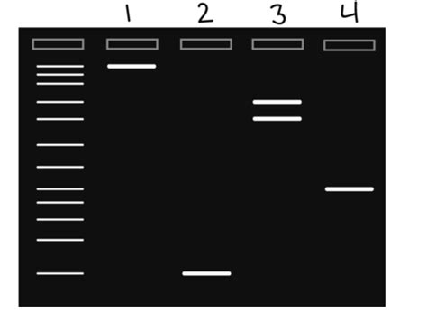 MICRO LAB FINAL Flashcards Quizlet