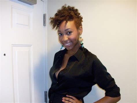 Best BEAUTY Albinism Images On Pinterest