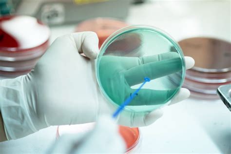 Anemia Panel ANEM GoldenPoint Scientific Labs