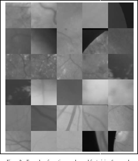 Figure 1 From A New Method For Online Retinal Optic Disc Detection Based On Cascade Classifiers