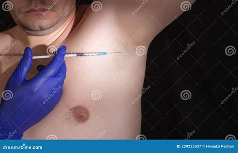 Treatment Of Hyperhidrosis In A Man With Armpits Sweating Concept Close Up Stock Image Image