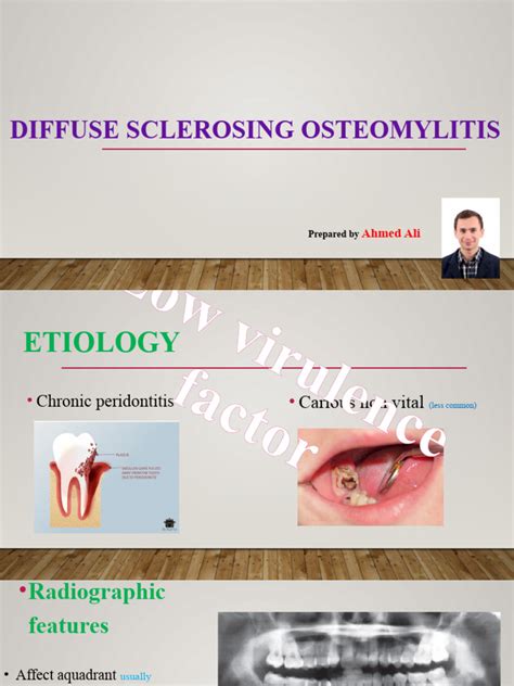 Diffrential Diagnosis Of Diffuse Sclerosing Osteomylitis Pdf Bone