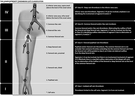 The Let Classification Description Of The Anatomical Distribution And