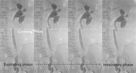 Fluoroscopy And Urethral Anatomy