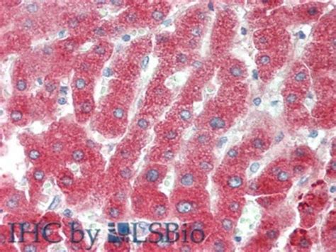 Complement C4b Polyclonal Antibody Invitrogen 20 μl Unconjugated