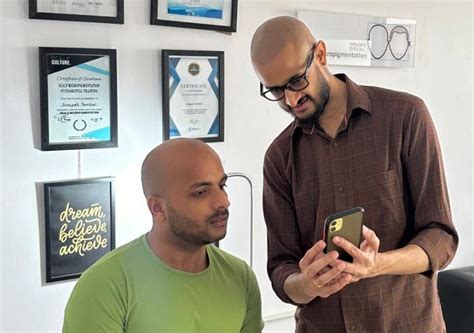 Scalp Micropigmentation Process And Procedure A Complete Guide