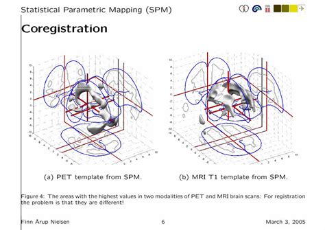 pdf statistical parametric mapping spm pute dtu dk faan ps