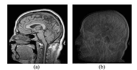 Figure 3 From Transfer Function Design For Volume Rendering Using K
