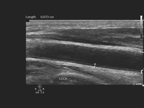 Keras Fitgenerator Flags Stop Iteration Issue And Predicted Image Is