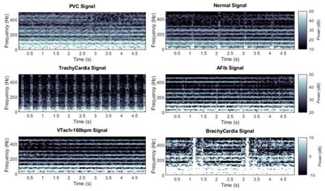 Electronics Free Full Text The Use Of Time Frequency Moments As Inputs Of Lstm Network For