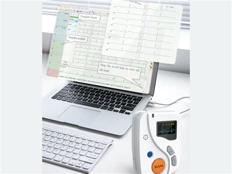 China Tlc6000 Dynamic Electrocardiograph Systems Suppliers Manufacturers Factory Wholesale