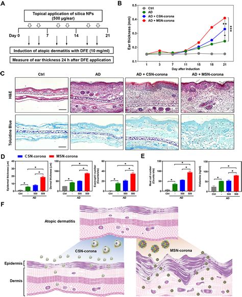 Mesoporous Silica Nanoparticles Aggravates Atopic Dermatitis Ijn