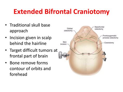 Craniotomypptx Death Injury Or Military Conflict Sensitive Topics