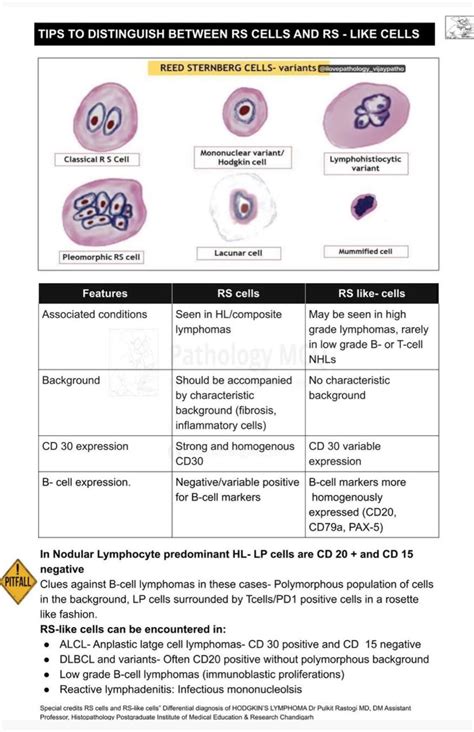 Some Differences Between RS Cells And RS Like Cells R Pathologymcqs